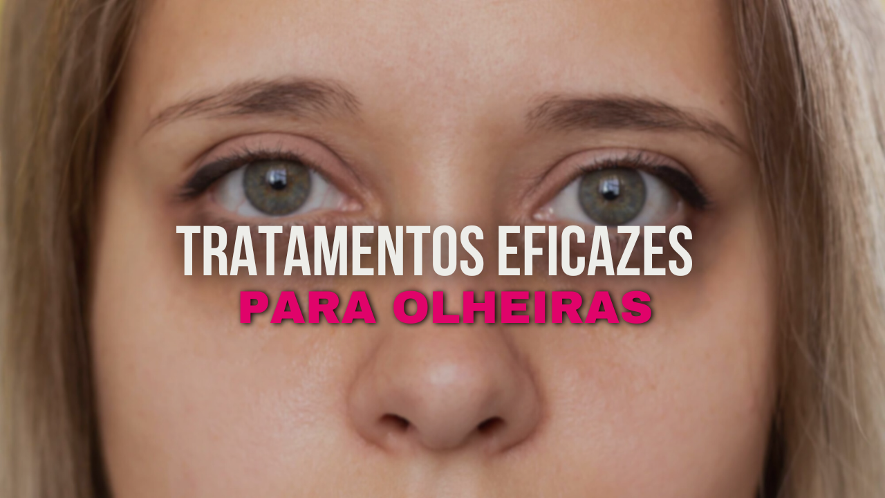 Como Realizar Tratamentos Eficazes Para Olheiras Esteticaporamor